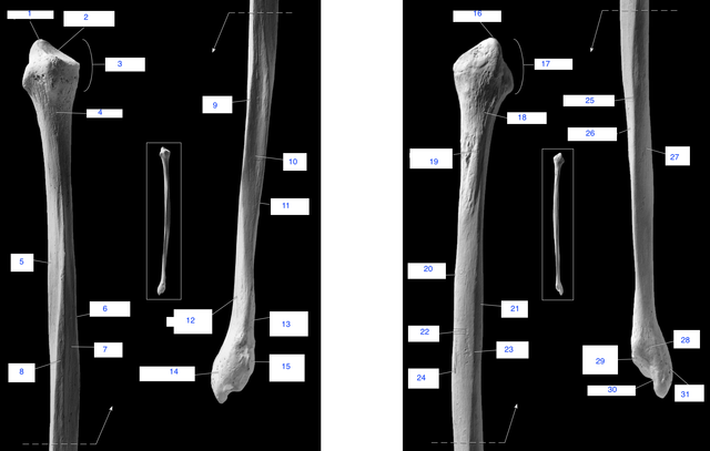 Fibula Quiz - By ryanspangler01