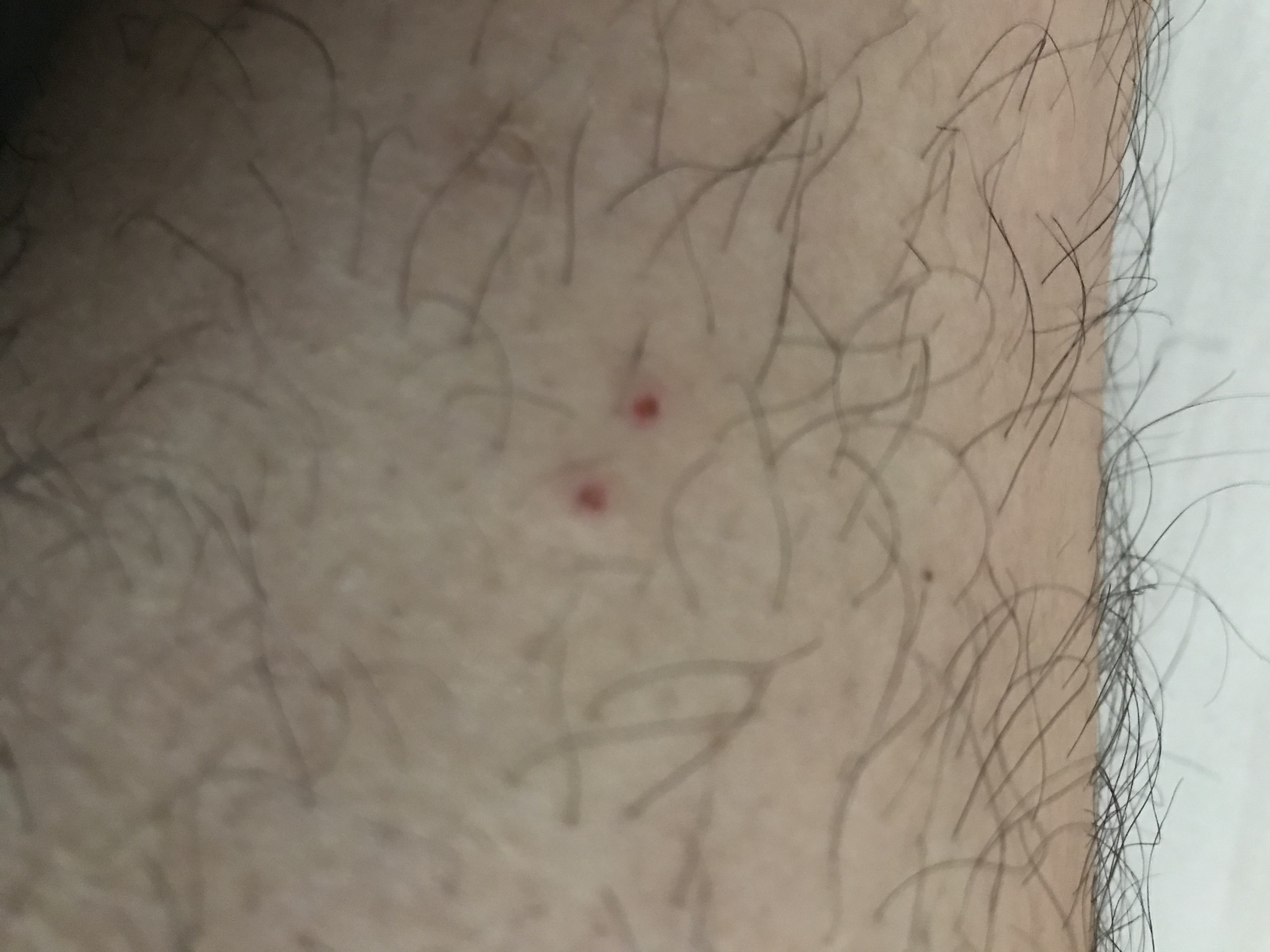 Bat Bite Size